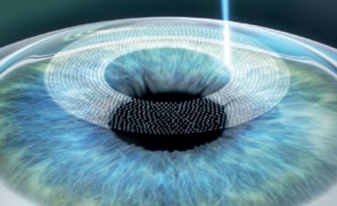 LVPEI :: Login Panel